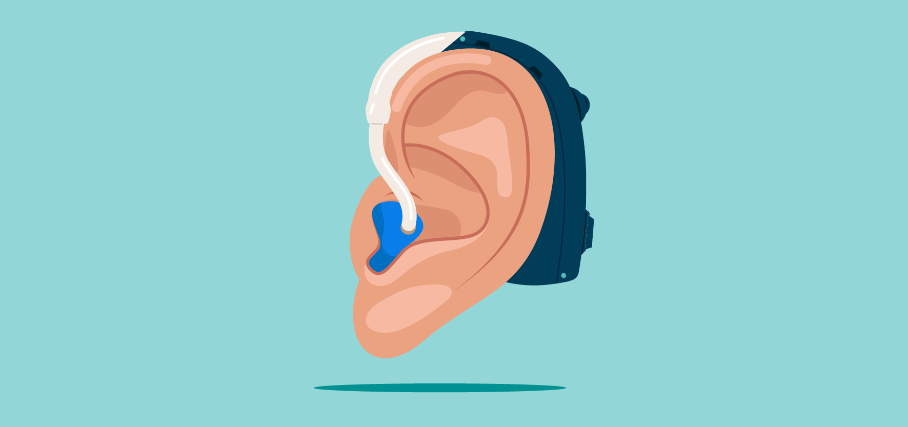 6 Exciting Innovations in Today’s Hearing Aids